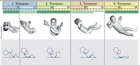 Pull-to-sit. – Neuropediatoolkit