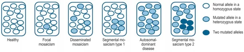 Mosaicismo y neuropediatría. – Neuropediatoolkit