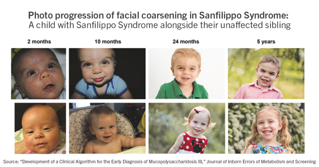 Facies tosca. – Neuropediatoolkit