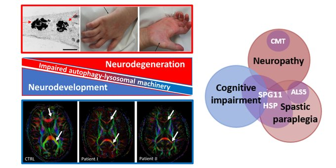Paraparesia espástica familiar. – Neuropediatoolkit